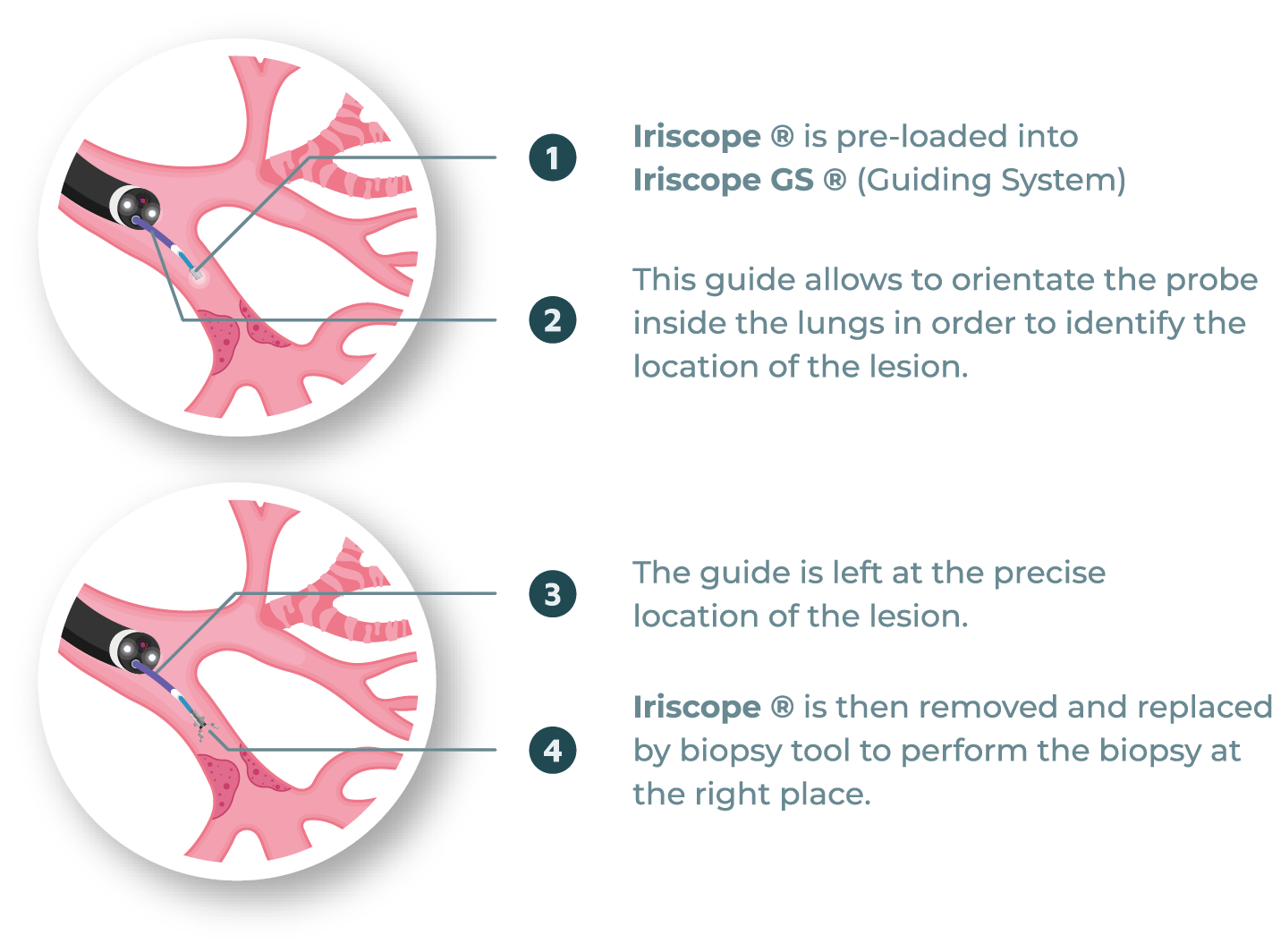 Lys Medical | Iriscope